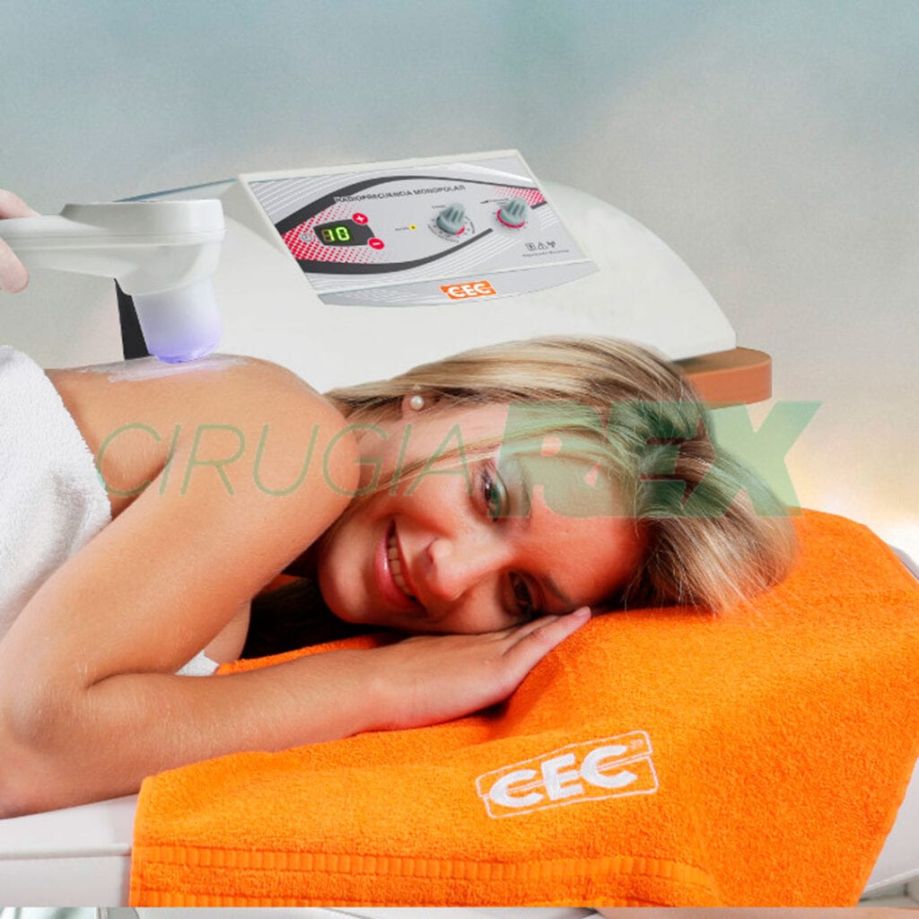 Radiofrecuencia Monopolar - Cirugía Rex